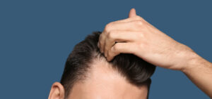 Por qué se cae el pelo | ¿Cuándo debemos preocuparnos?