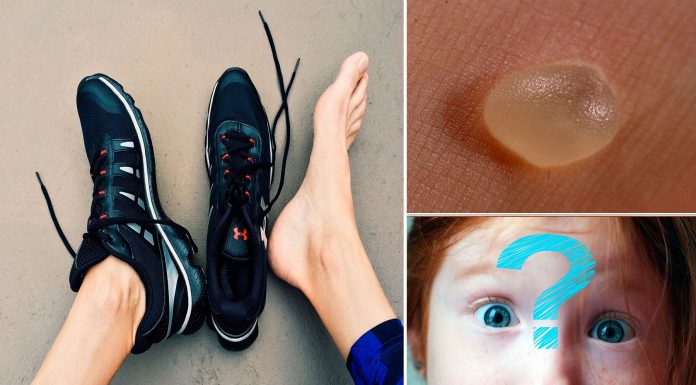 flictenas Archives - Supercurioso