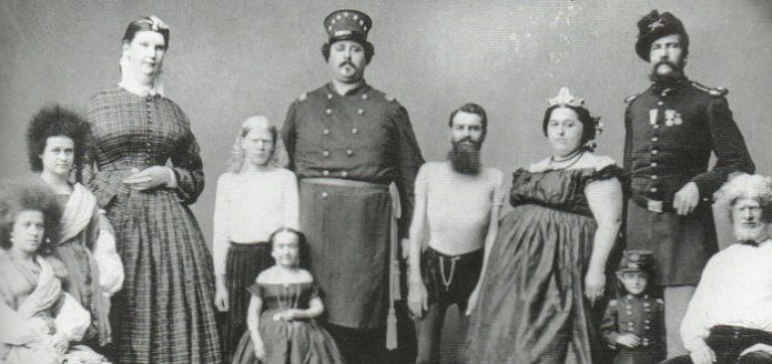 Isaac W. Sprague | El hombre al que llamaron el "esqueleto viviente"