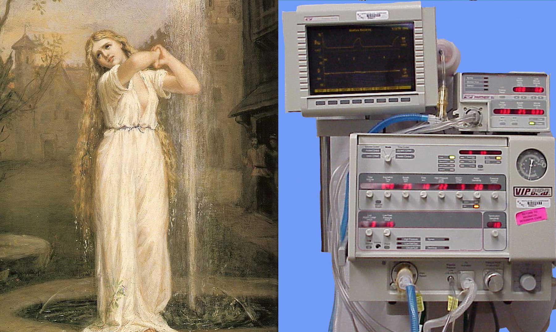 La leyenda Alsaciana de Ondina y su relación con el Síndrome de Ondina