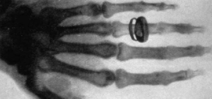 ¿Cuál fue la primera radiografía de la historia? | Una técnica esencial